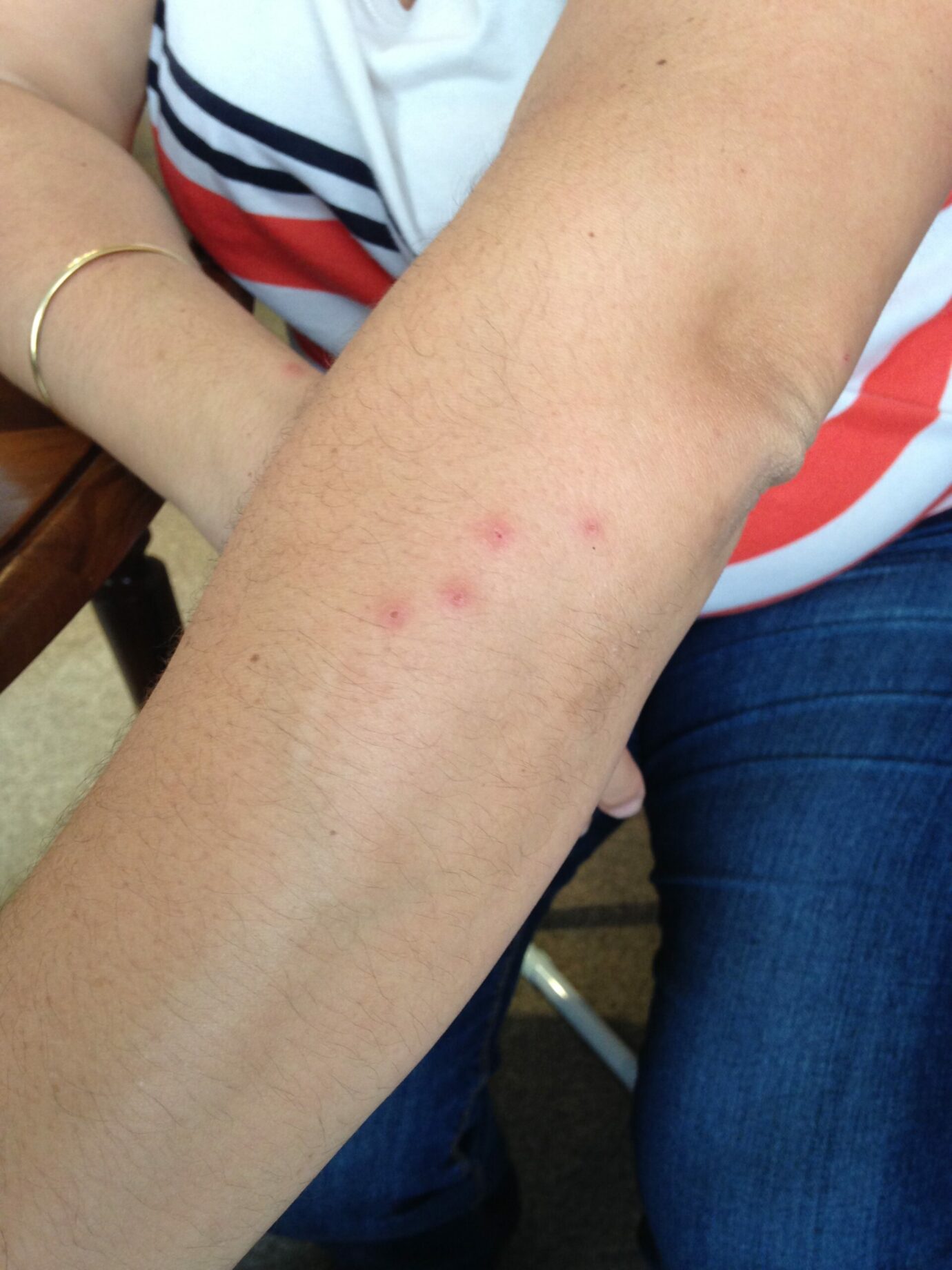 Piqures - DogScan - Punaise de lit - détection de puces de lit avec un ...